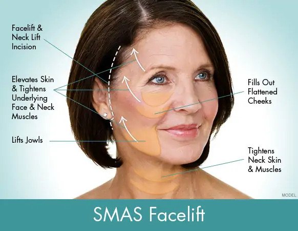 Facelift Thousand Oaks | Facelift Surgery Westlake Village